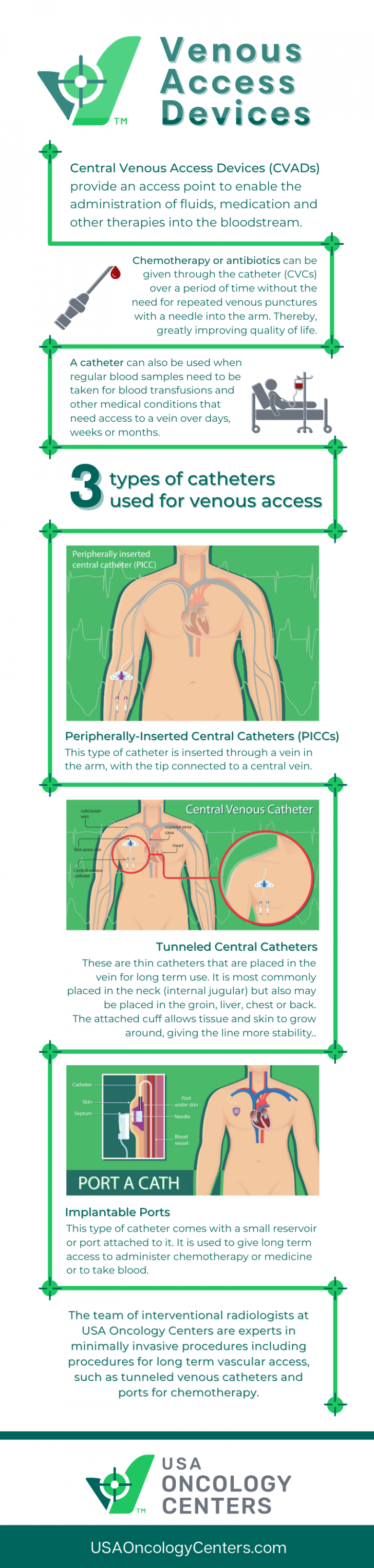 Venous Access Devices | USA Oncology Centers