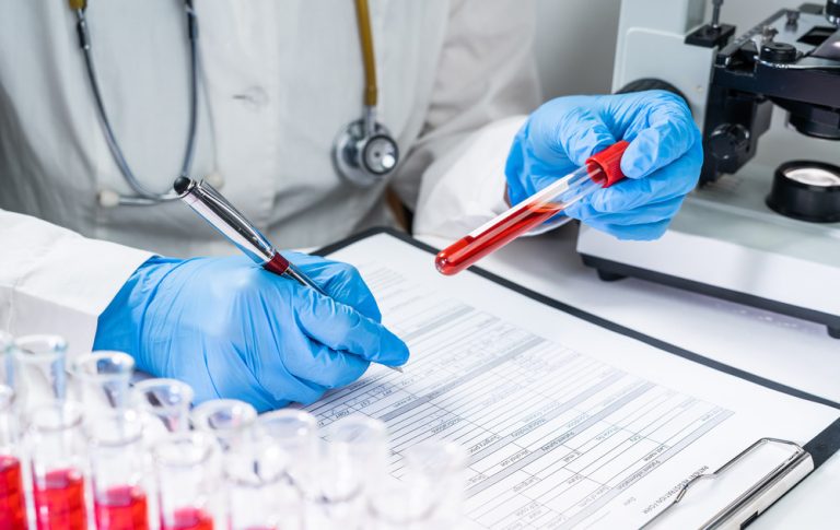 Can Liver Cancer Be Detected By A Blood Test USA Oncology Centers can-liver-cancer-be-detected-by-a-blood-test-usa-oncology-centers